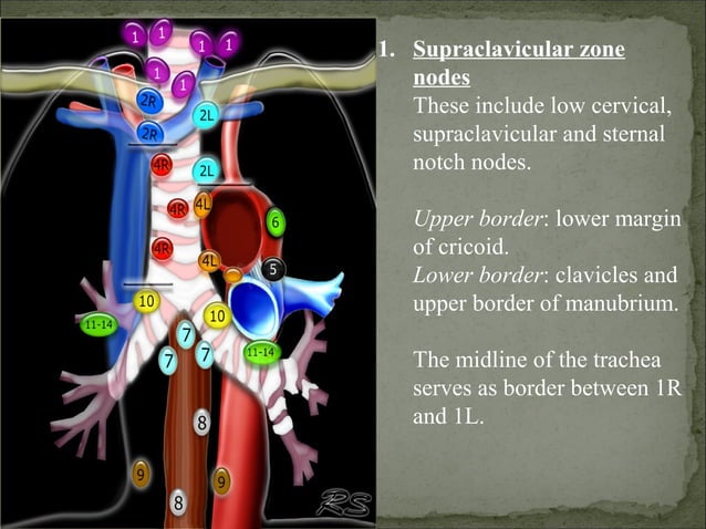 Hrct anatomy | PPT | Lung and Respiratory Health | Diseases and Conditions