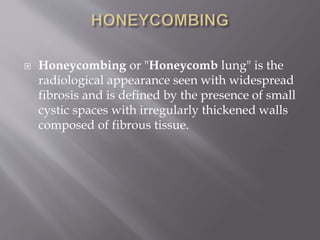 HR CT CHEST.pptx