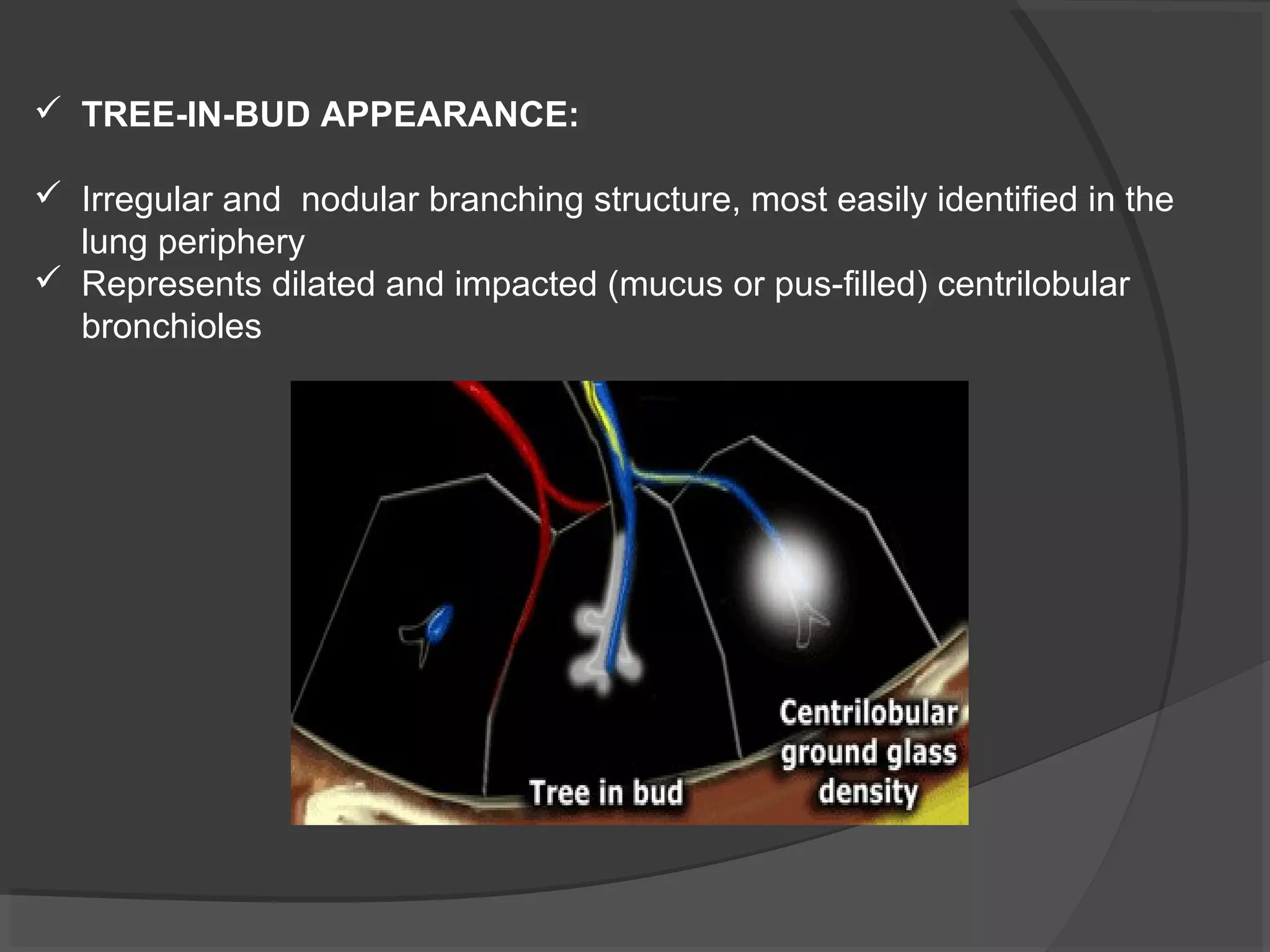 Hrct chest technique and interpretation | PPT