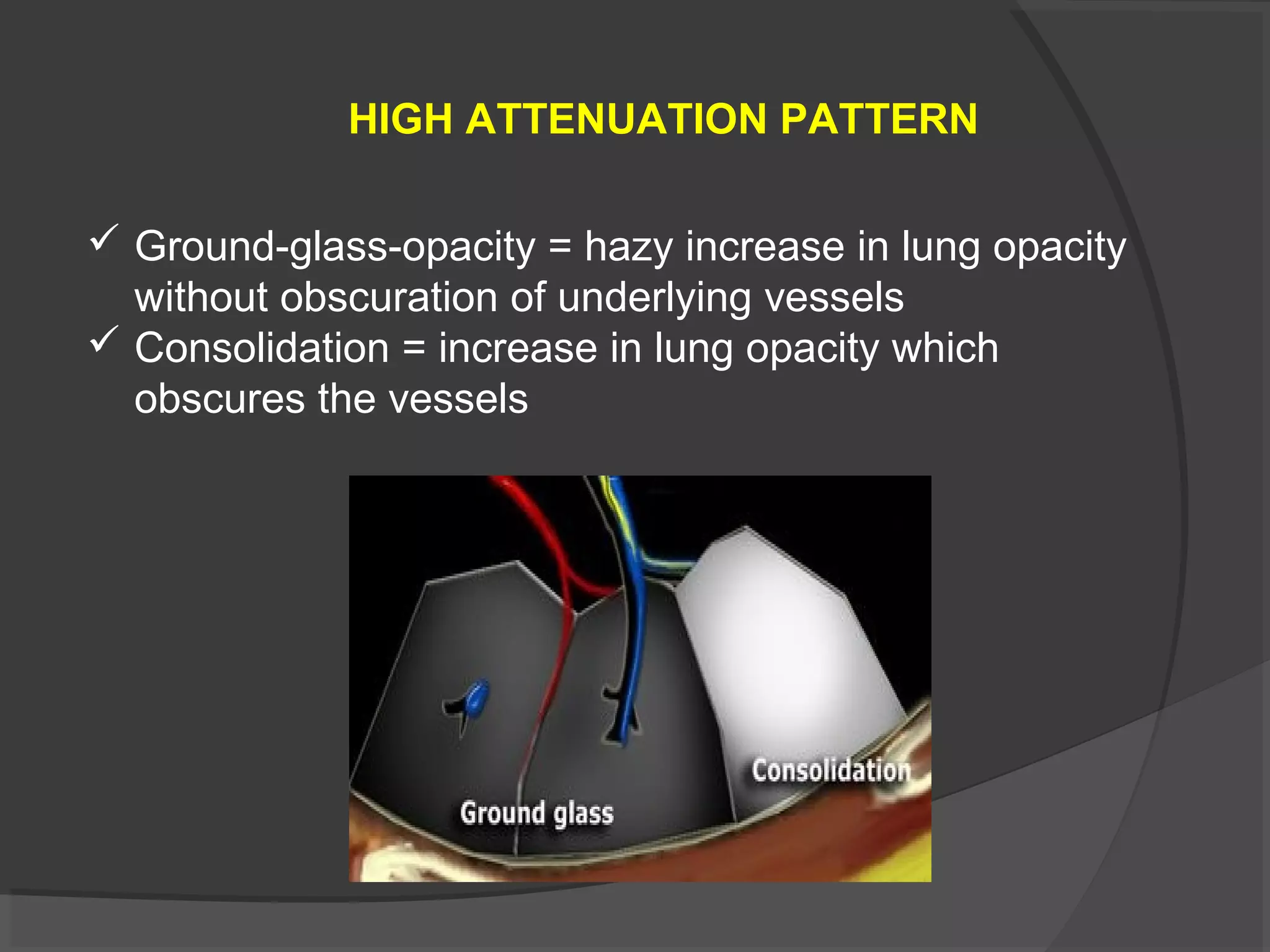 Hrct chest technique and interpretation | PPT
