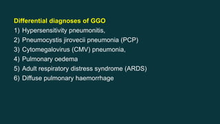 Radiological Approach To Diffuse Lung Diseases | PPTX