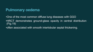 Radiological Approach To Diffuse Lung Diseases | PPTX