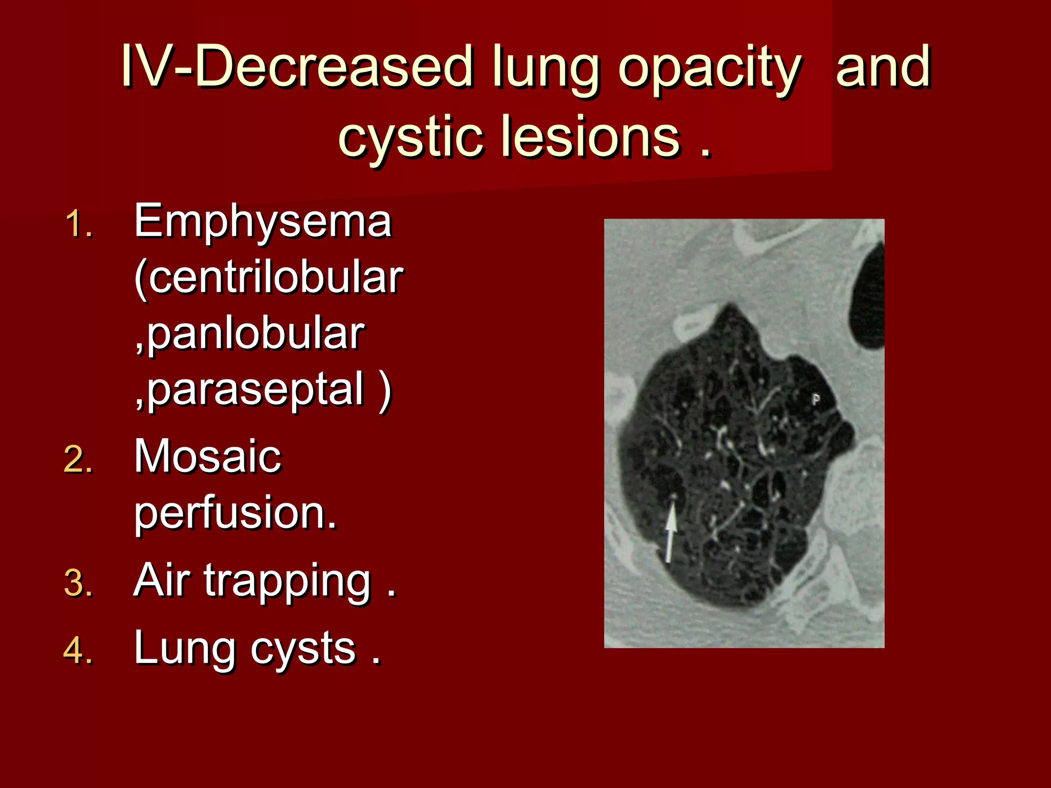 Hrct in diagnosis of diffuse lung diseases | PPT