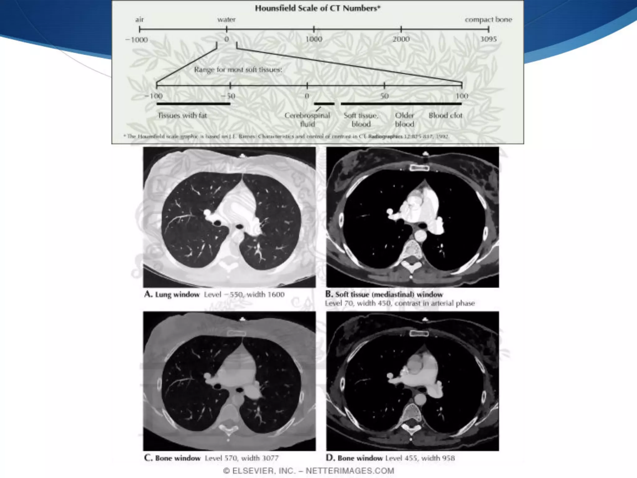 HRCT TECHNIQUE AND INTERPRETATION | PDF