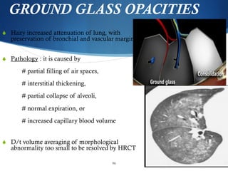 HRCT TECHNIQUE AND INTERPRETATION | PDF