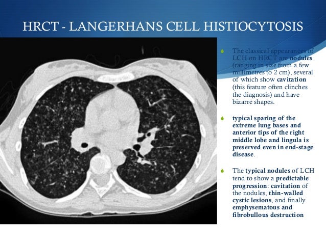 HRCT TECHNIQUE AND INTERPRETATION