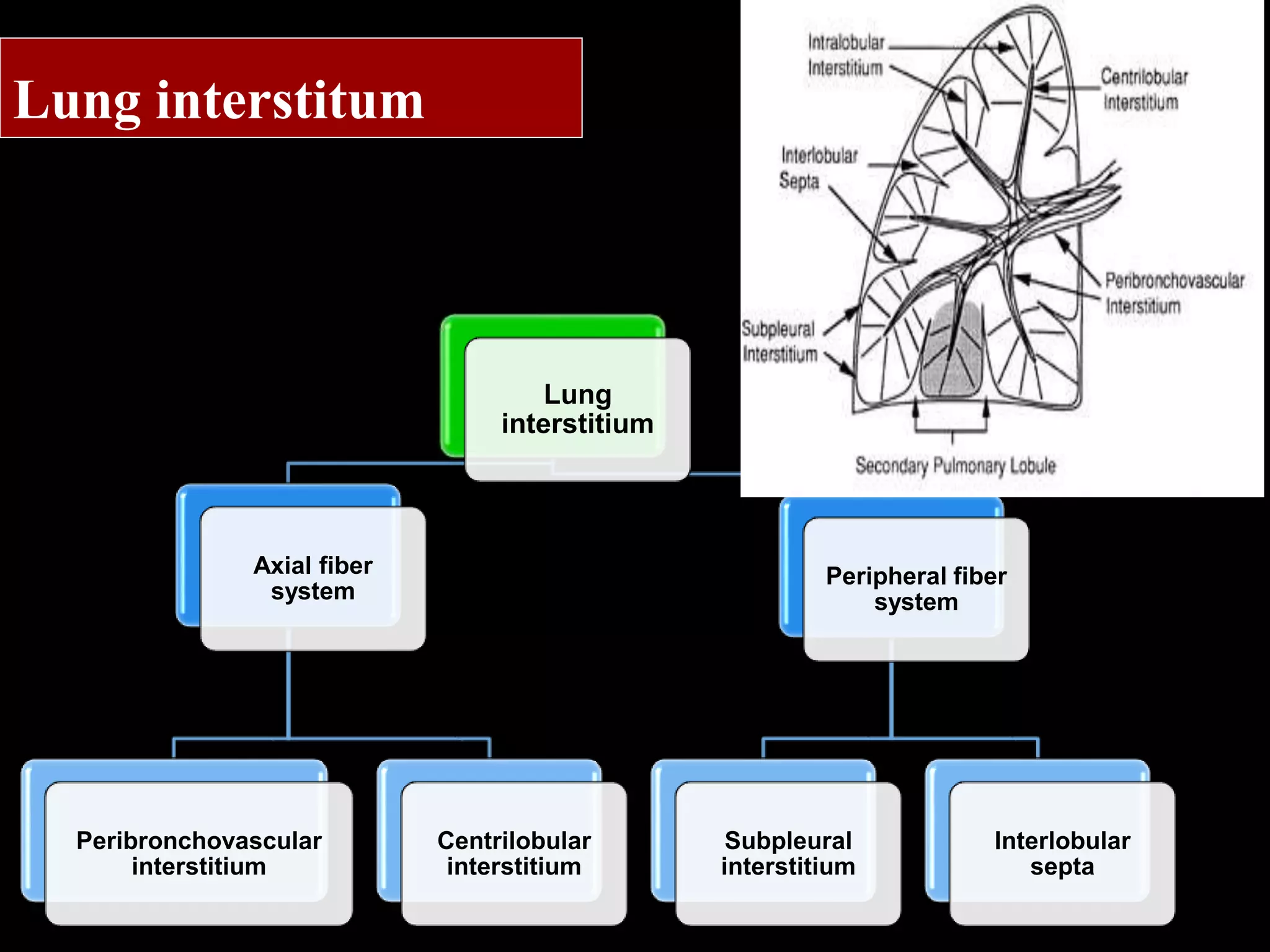 HRCT Chest - By Dr. Tinku Joseph | PPTX