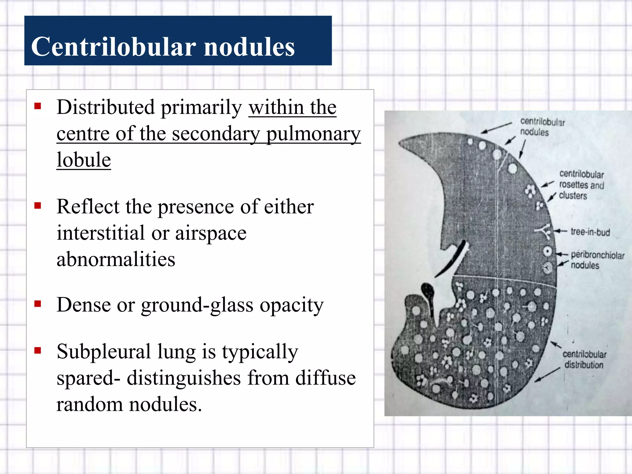 HRCT Chest - By Dr. Tinku Joseph | PPTX