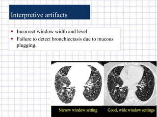 HRCT Chest - By Dr. Tinku Joseph | PPTX