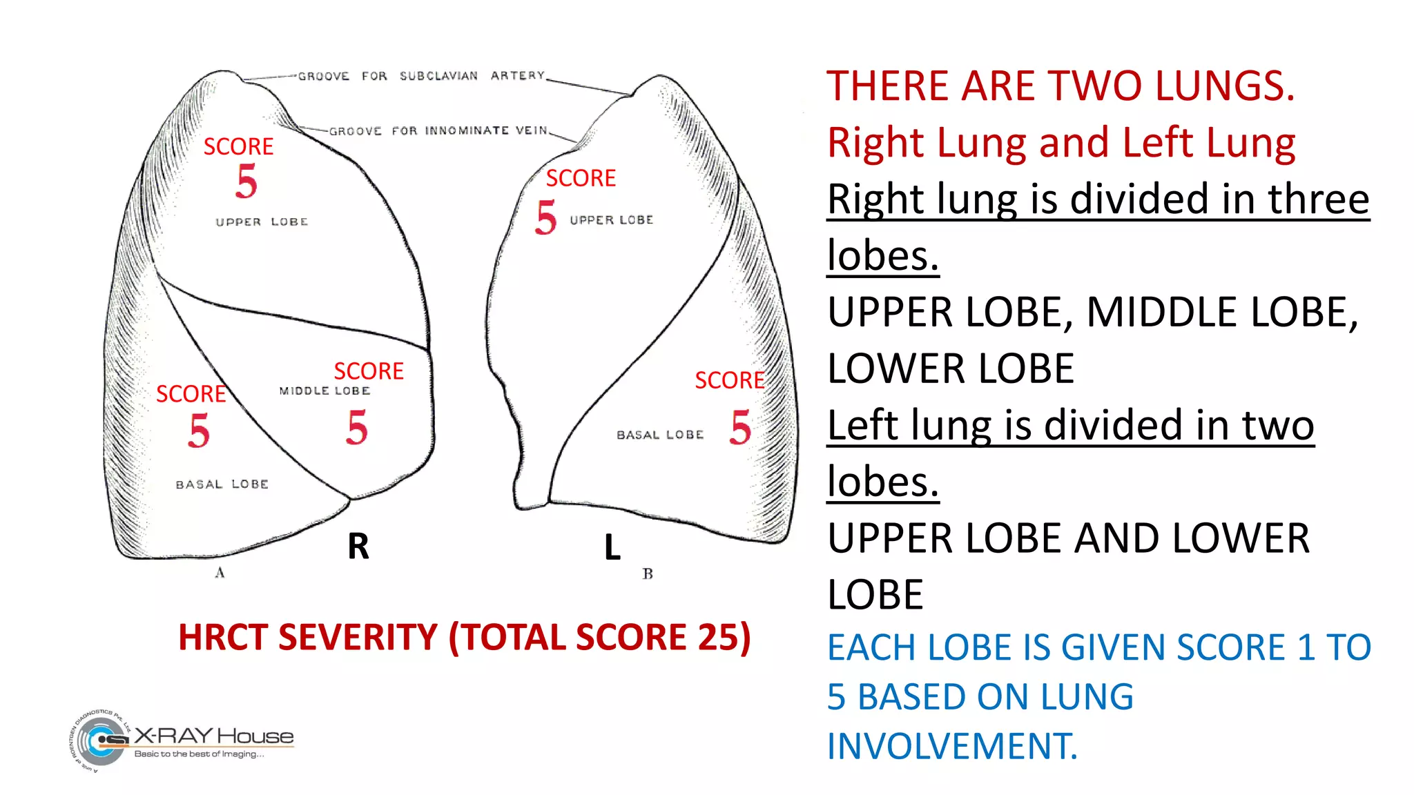 Hrct interpretation final pdf | PDF | Lung and Respiratory Health ...