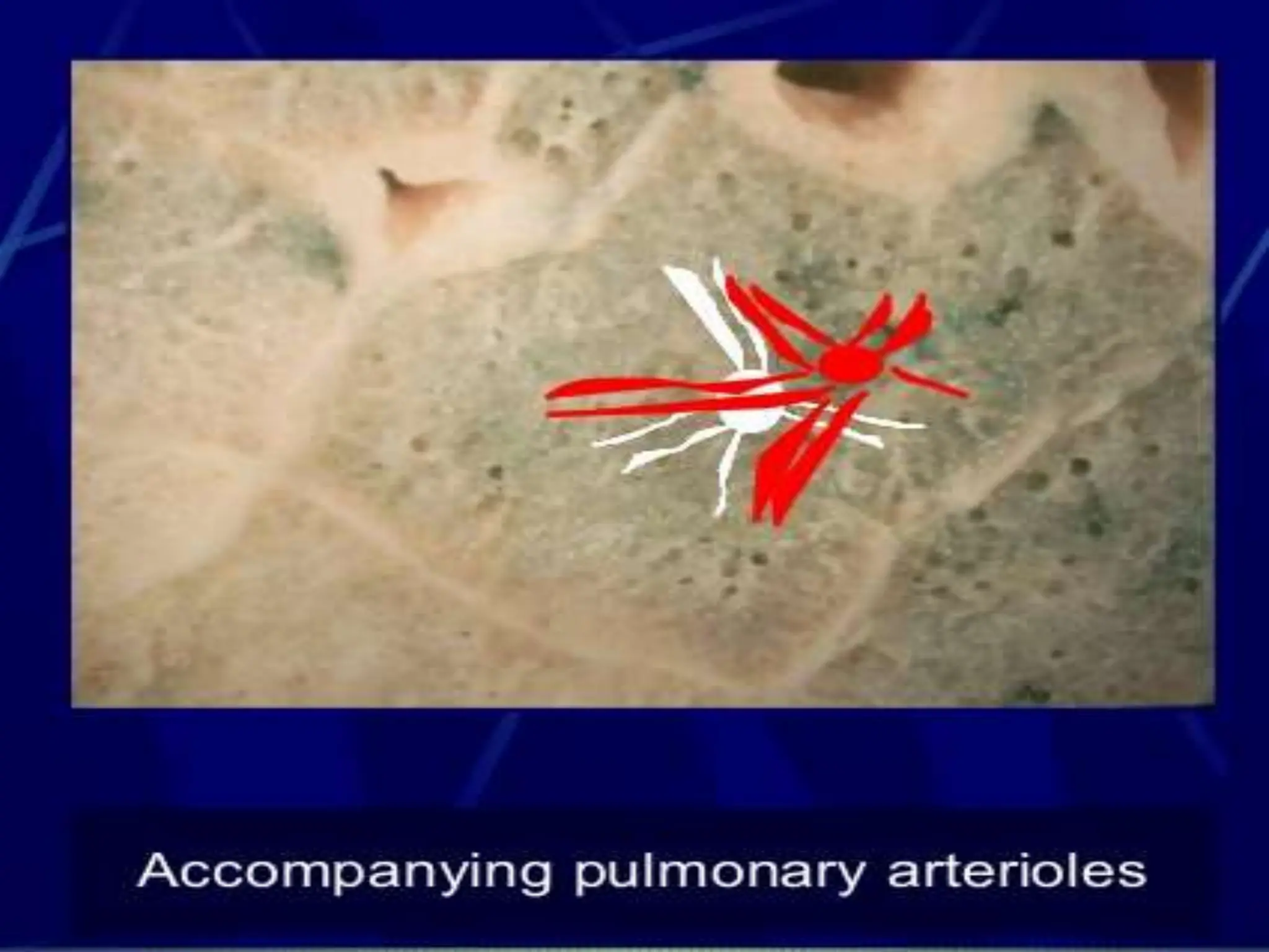 High resolution computer tomogtraphy.pptx