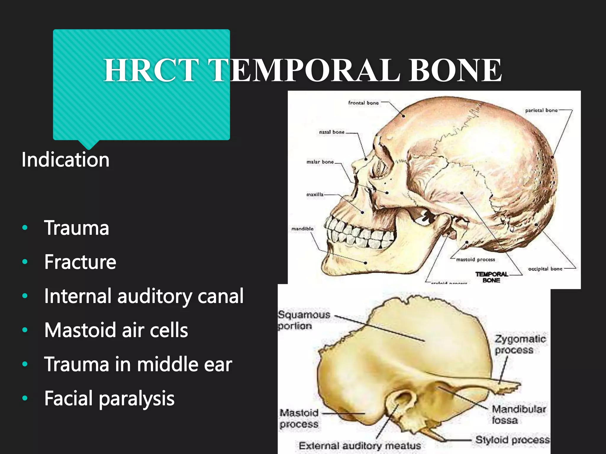 HRCT CHEST/TEMPORAL BONE PROTOCOL.pptx