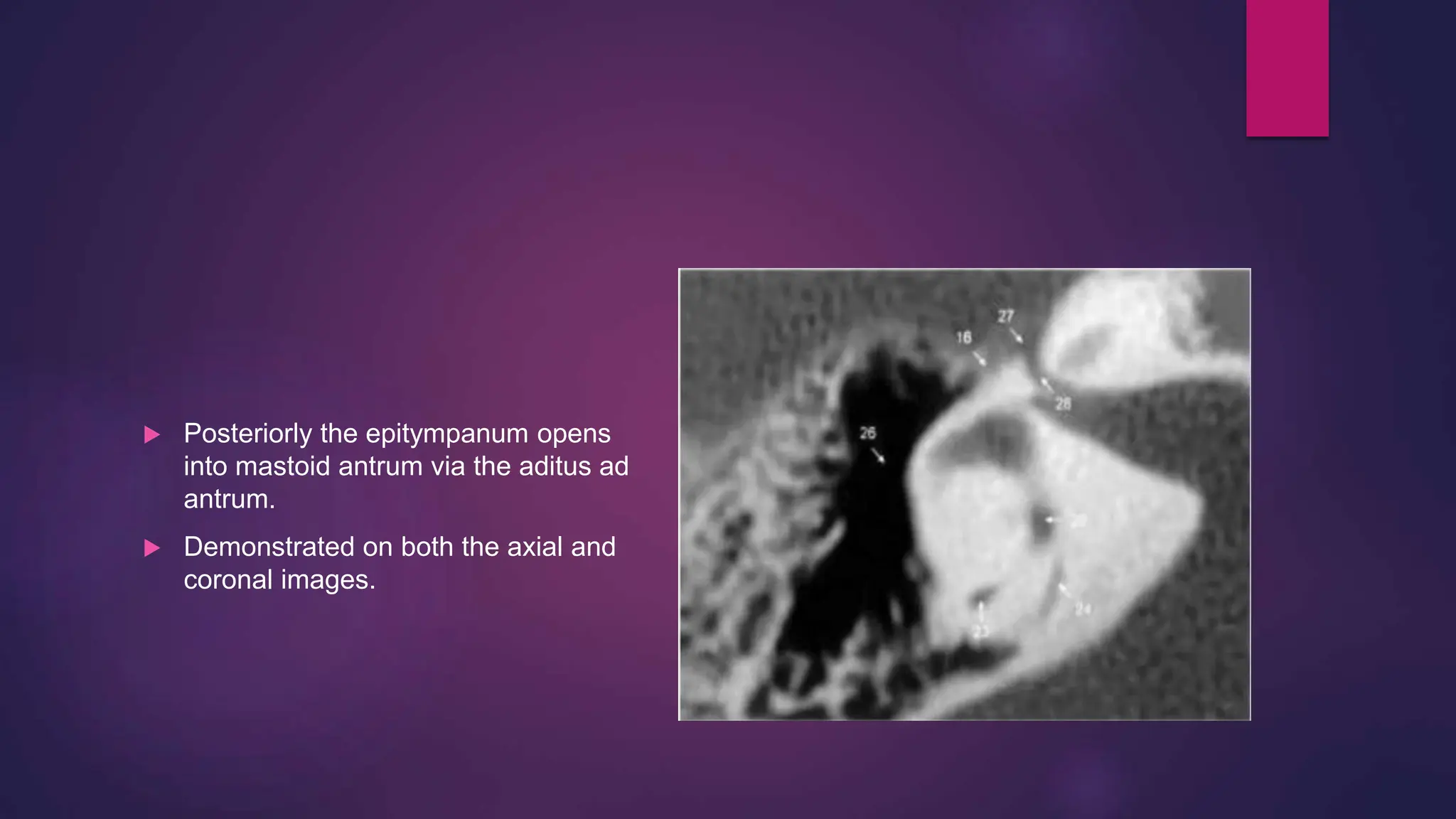 High Resolution Computer TomographyTEMPORAL BONE Pathology.pptx