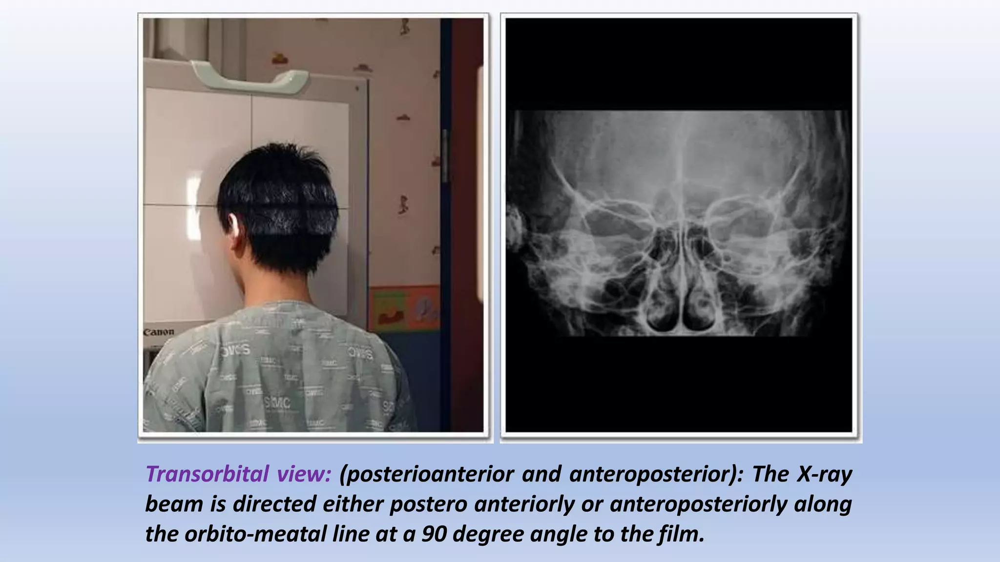 Hrct temporal bone pk1 ppt | PPTX