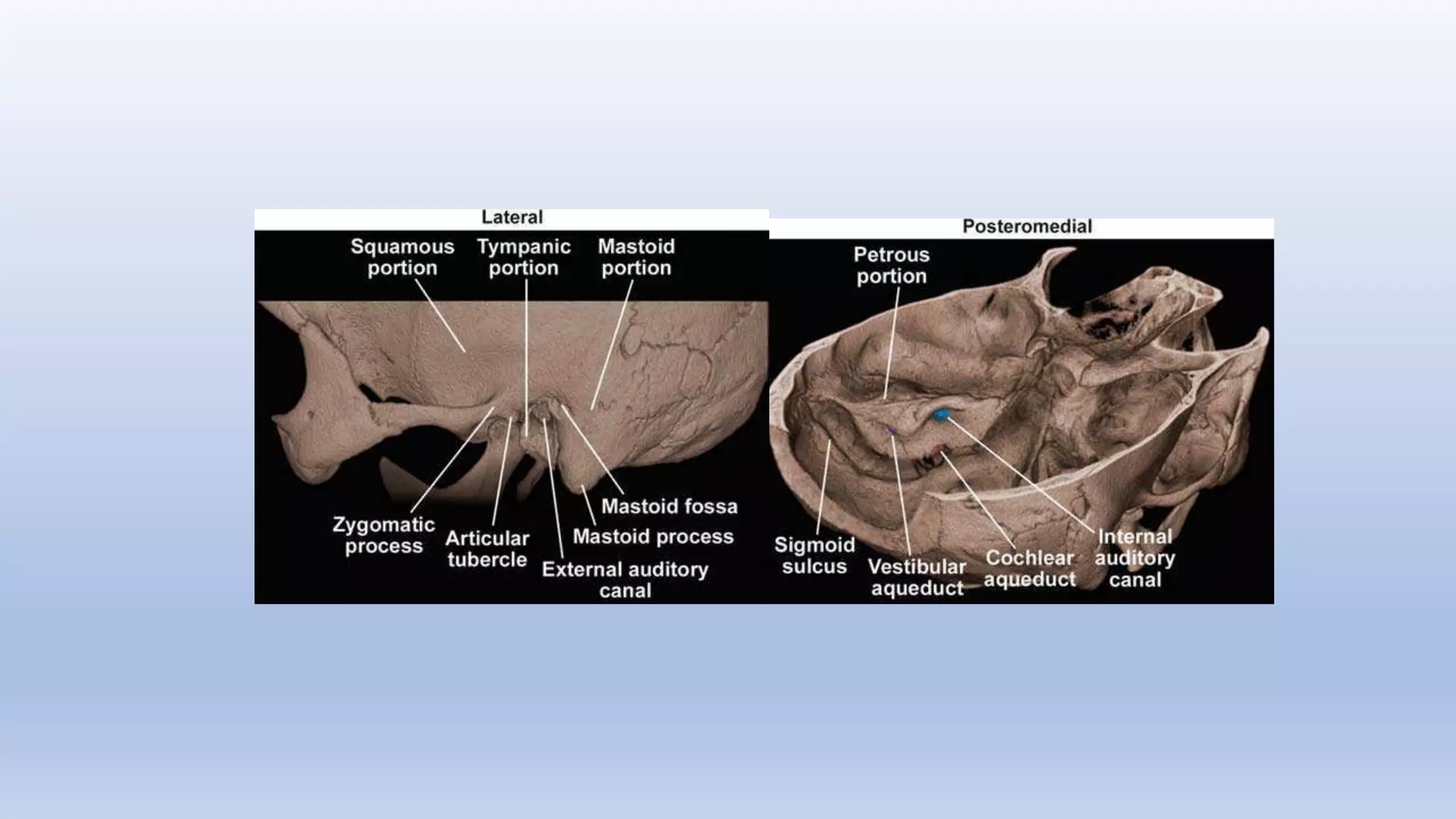 Hrct temporal bone pk1 ppt | PPTX