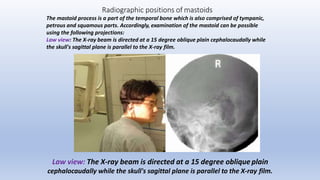 Hrct temporal bone pk1 ppt | PPTX