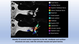 Hrct temporal bone pk1 ppt | PPTX