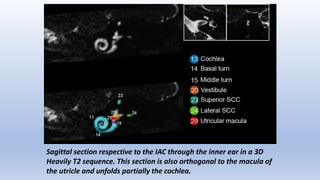 Hrct temporal bone pk1 ppt | PPTX