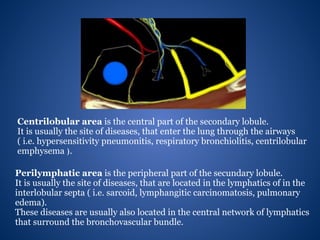 Hrct thorax- A-Z | PDF
