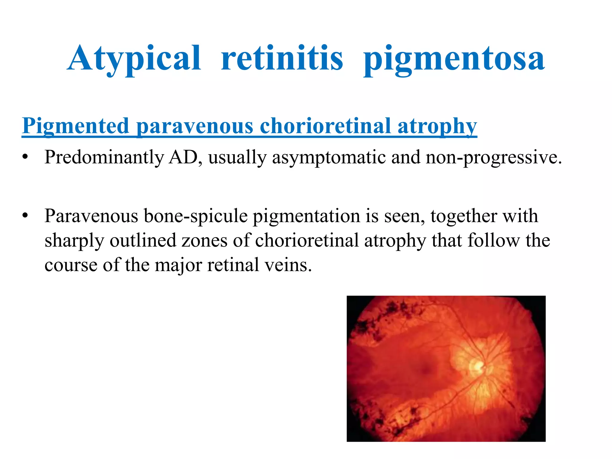 Hereditary Retinal disease .pptx