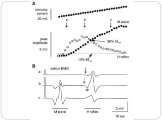 H Reflexes in Clinical Practice | PPTX