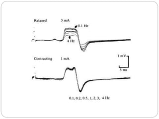 H Reflexes in Clinical Practice | PPTX