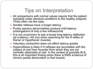 H Reflexes in Clinical Practice | PPTX