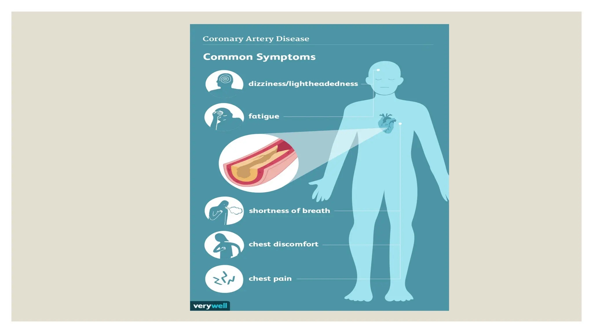 Hridya Rog (cardiac disorder, function).pptx