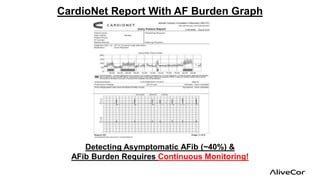 Hrs2015 ecg monitoring_de_albert | PPTX | Heart and Cardiovascular ...