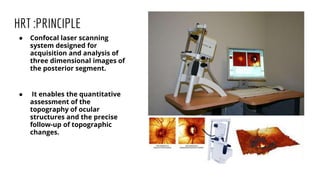 Heidelberg retinal tomography Introduction to interpretation | PPTX