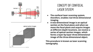 Heidelberg retinal tomography Introduction to interpretation | PPTX