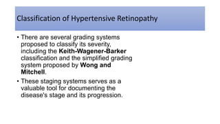 Hypertensive Retinopathy.pptx