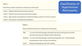 Hypertensive Retinopathy.pptx