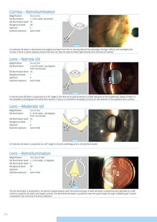 Getting the most from your Haag-Streit slit lamp | PDF