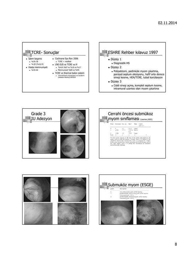 Hysteroscopy for abnormal uterine bleeding | PDF