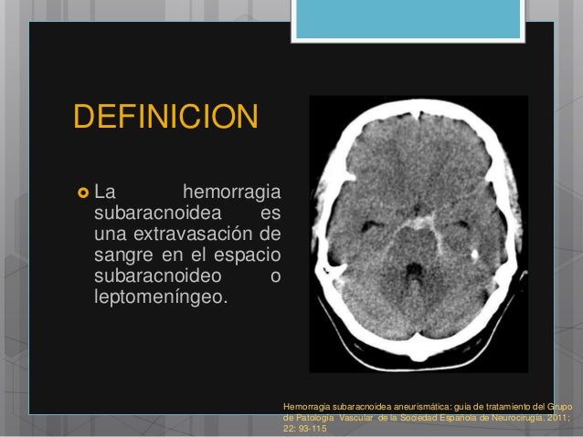 Hemorragia Subaracnoidea Hemorragia Subaracnoidea Cisternas Y Cisuras