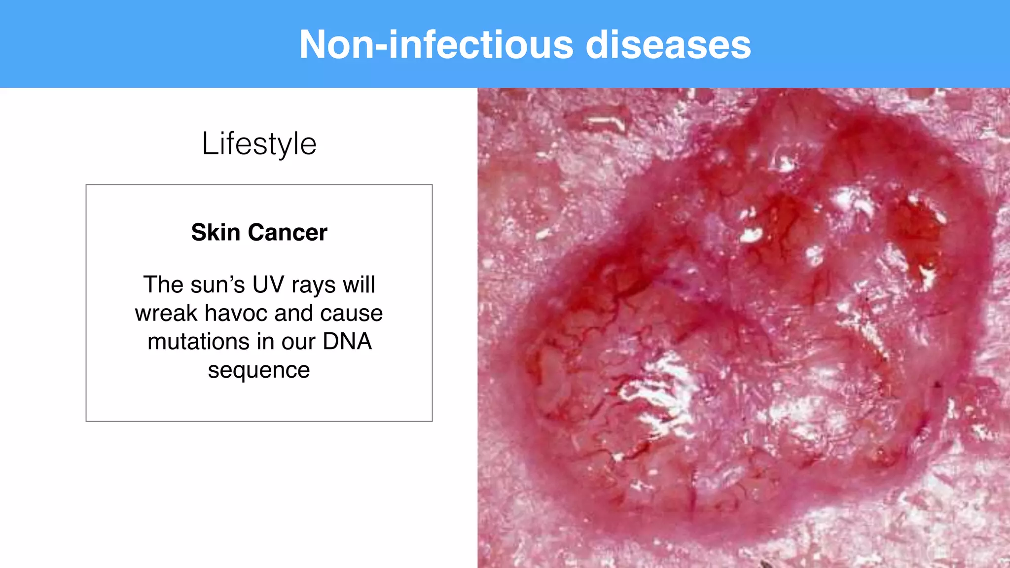HSC Biology 3.2: Infectious and non infectious disease | PPT
