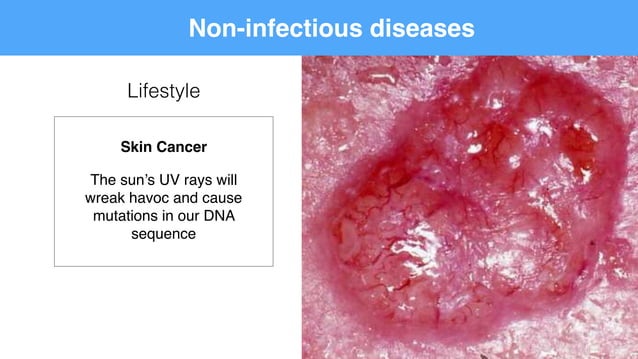 HSC Biology 3.2: Infectious and non infectious disease | PPT