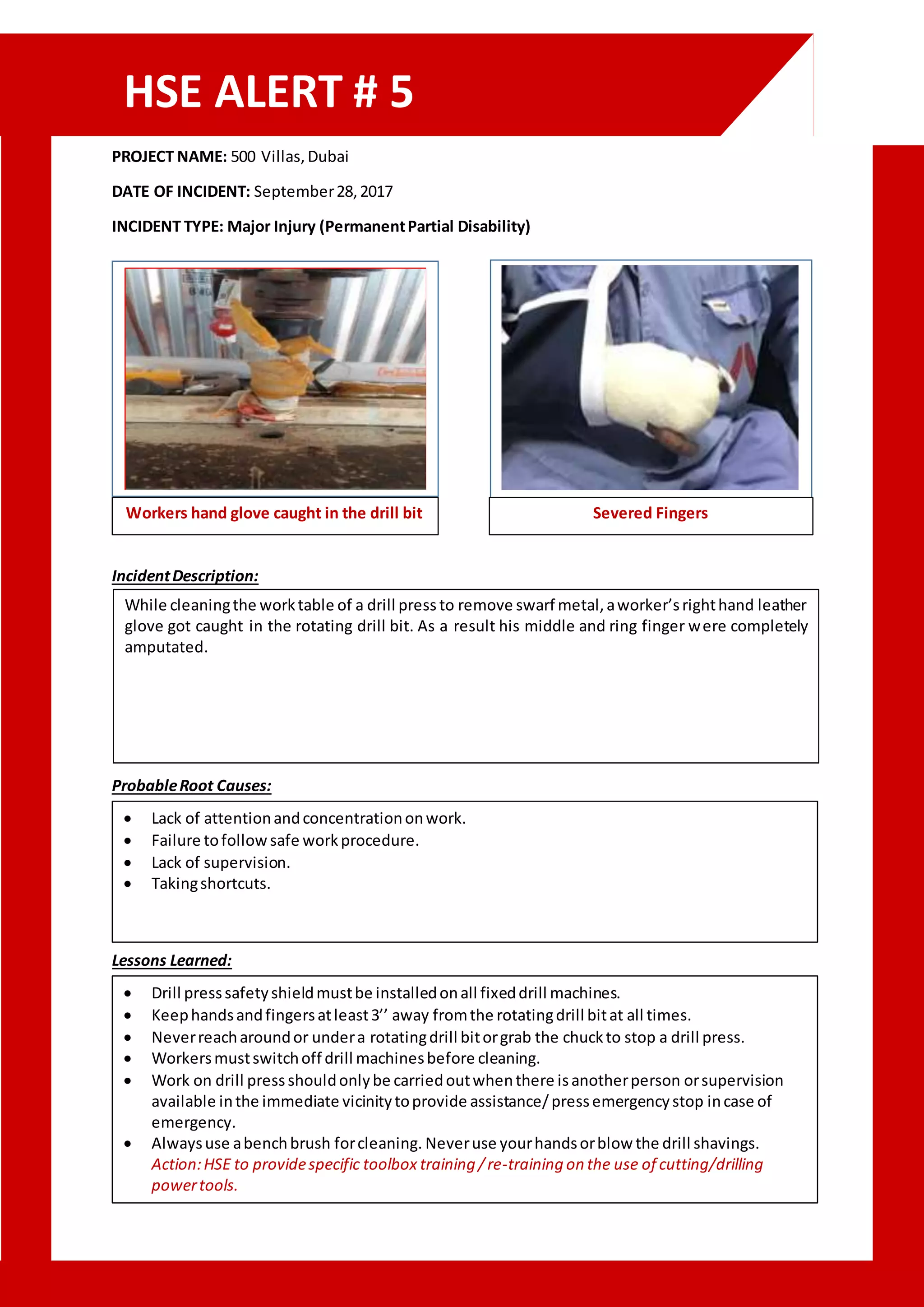 Hse alert 5 2017 finger amptation incident | DOCX