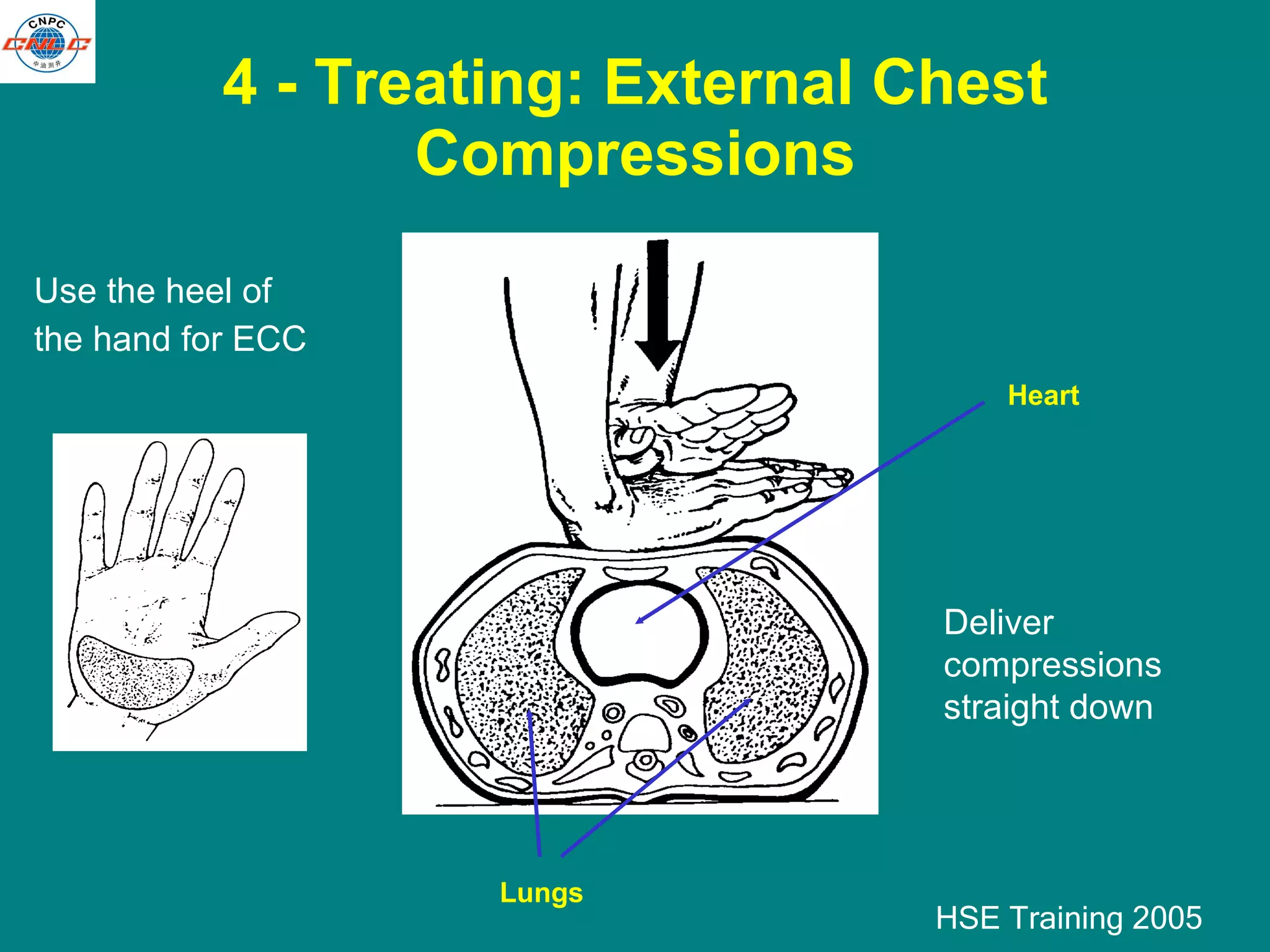 Hse First Aid, Cpr | PPT