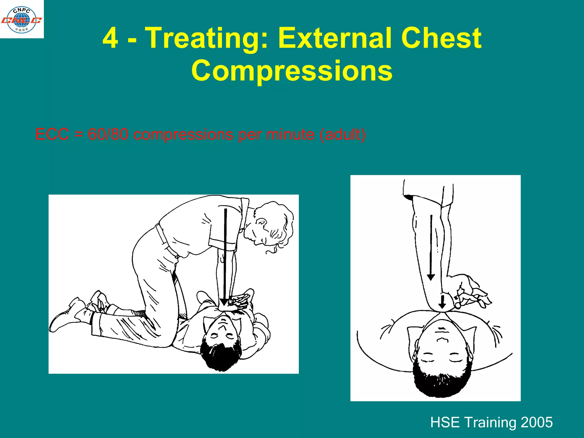 Hse First Aid, Cpr | PPT