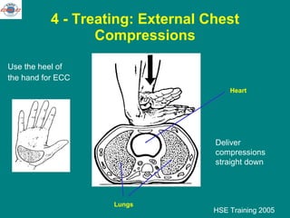 Hse First Aid, Cpr | PPT