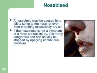 HSE~First Aid Training for employees and management | PPT