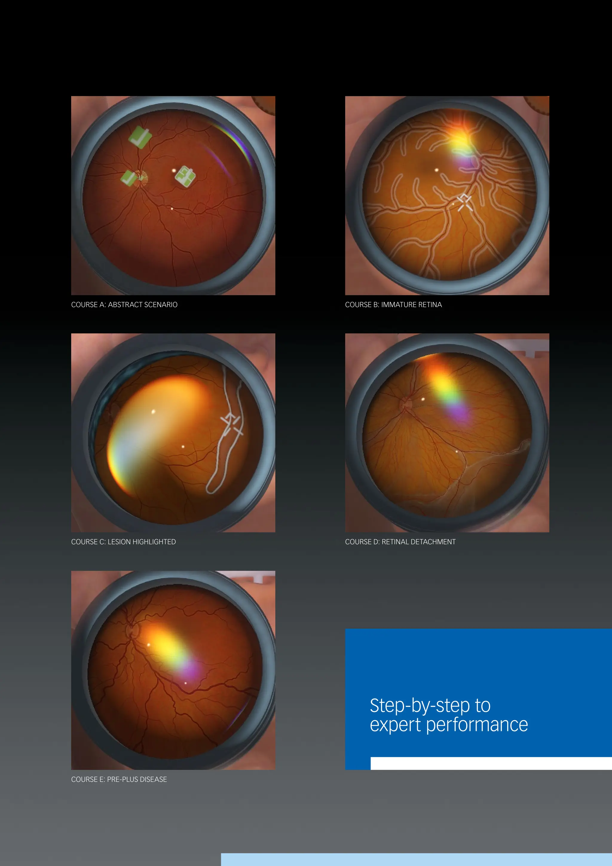 Haag-Streit Simulation Eyesi Indirect ROP Brochure | PDF | 3-D Graphics ...