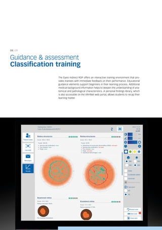 Haag-Streit Simulation Eyesi Indirect ROP Brochure | PDF | 3-D Graphics ...