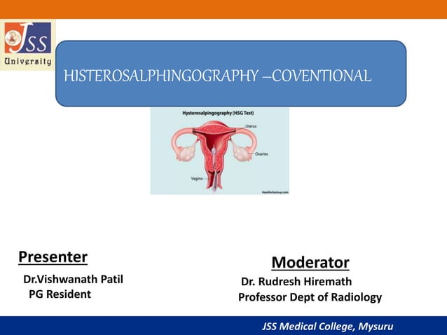 Hysterosalphyngography | PPTX
