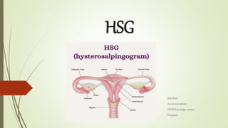 HSG.hysteriosalpingiography | PPT