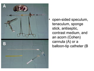 Hysterosalpingography cases | PPT