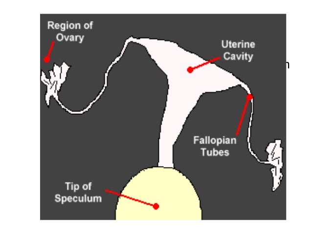 Hysterosalpingography cases