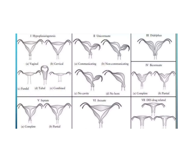 HSG AND FISTULOGRAM.pptx | Pregnancy | Reproductive Health